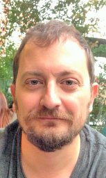 Stent-assisted coil embolization of challenging intracranial aneurysms ...