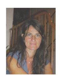 Two novel cases of compound heterozygous mutations in mitofusin2 ...