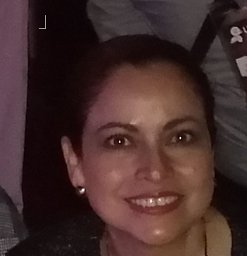 Sol-gel synthesis of Tb-doped hydroxyapatite with high performance as ...