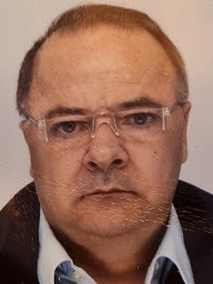 Effects of Stimulation of Soluble Guanylate Cyclase on Diabetic ...