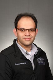 Outcomes of Acute Myocardial Infarction in Patients with Systemic Lupus ...