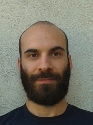 Prophylactic Therapy for Long-Term Ocular Discomfort After Cataract ...