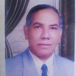 Right atrial thrombus in a neonate with Aspergillus colonization ...